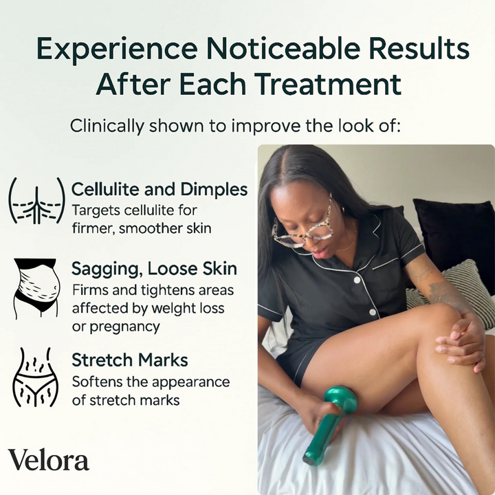 Products – Velora